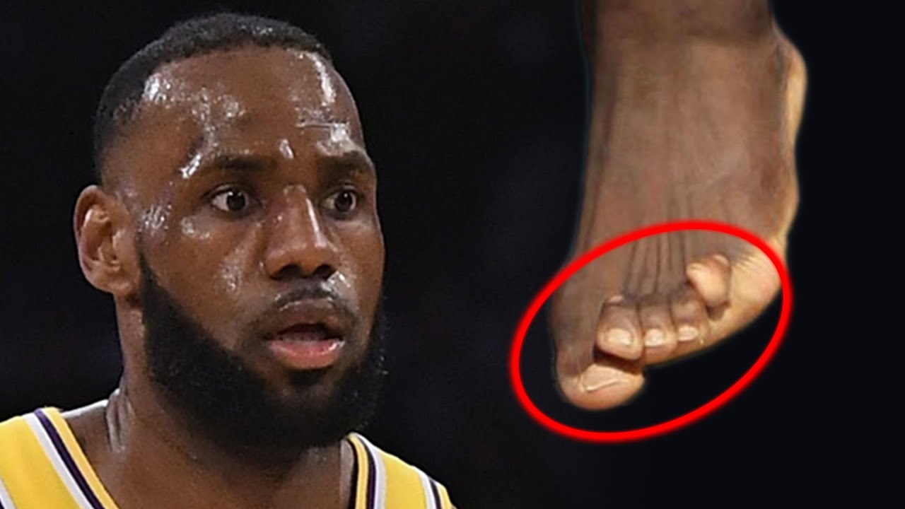 La impactante foto que muestra cómo tiene los dedos del pie LeBron ...